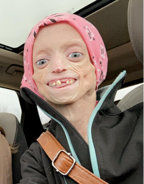 Meet the Kids | The Progeria Research Foundation